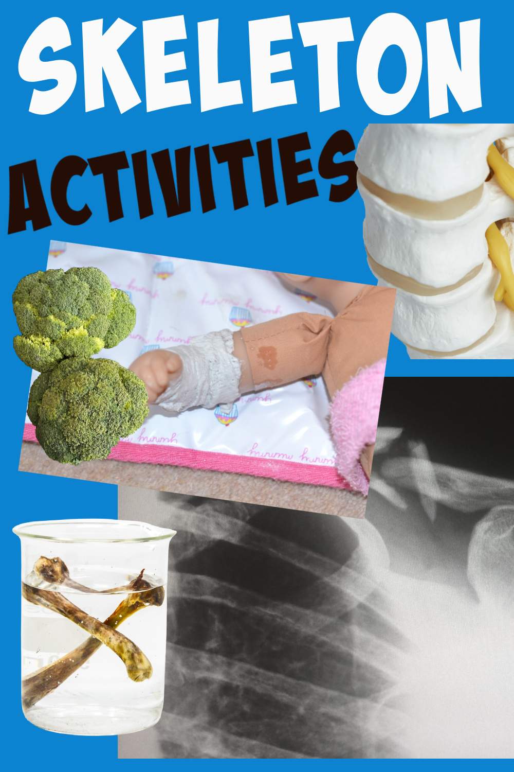 Skeleton Activities for Kids - Healthy Bones