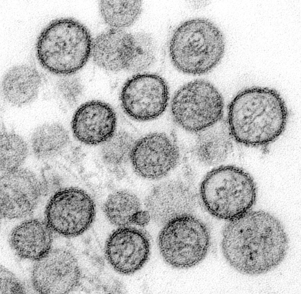 What is Hantavirus?